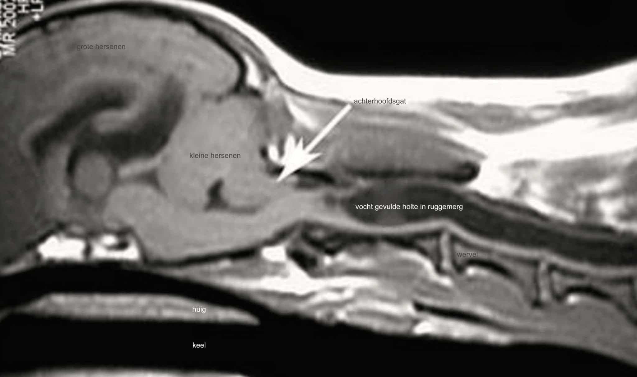 Syringomyelie - Medisch Centrum Voor Dieren
