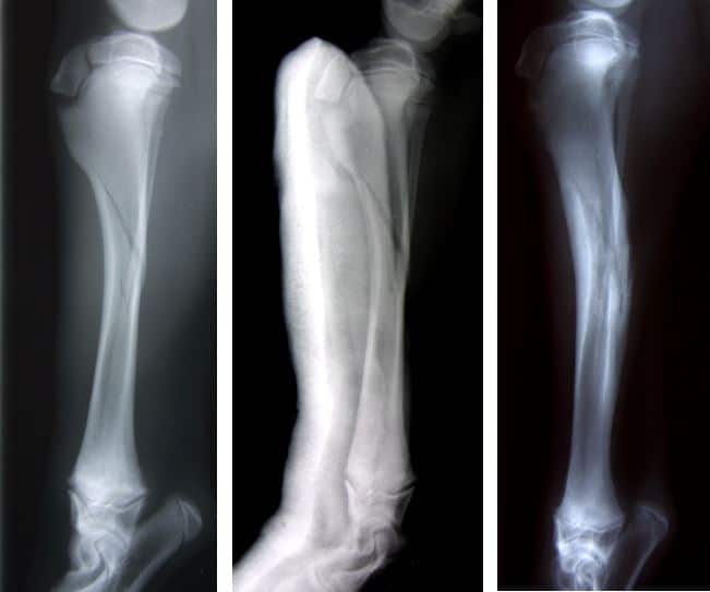 Botbreuk behandeling met gips - Medisch Centrum Voor Dieren