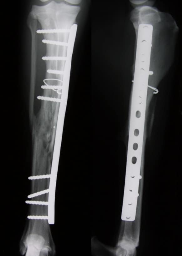 Botbreuk behandeling met platen en schroeven - Medisch Centrum Voor Dieren